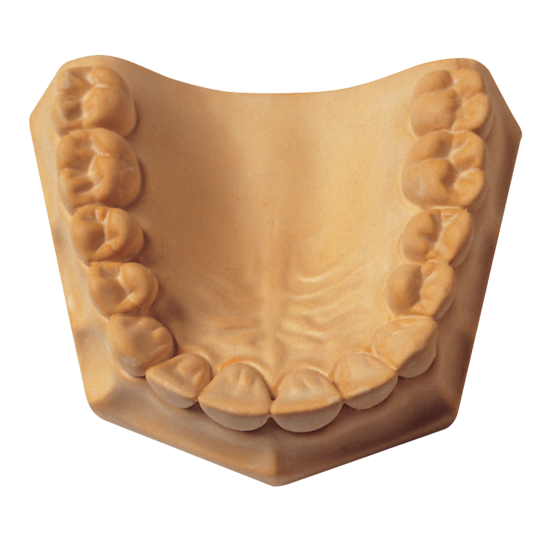 Whip Mix QUICKSTONE LABORATORY STONE BUFF 33#/15KG – Garland Dental ...