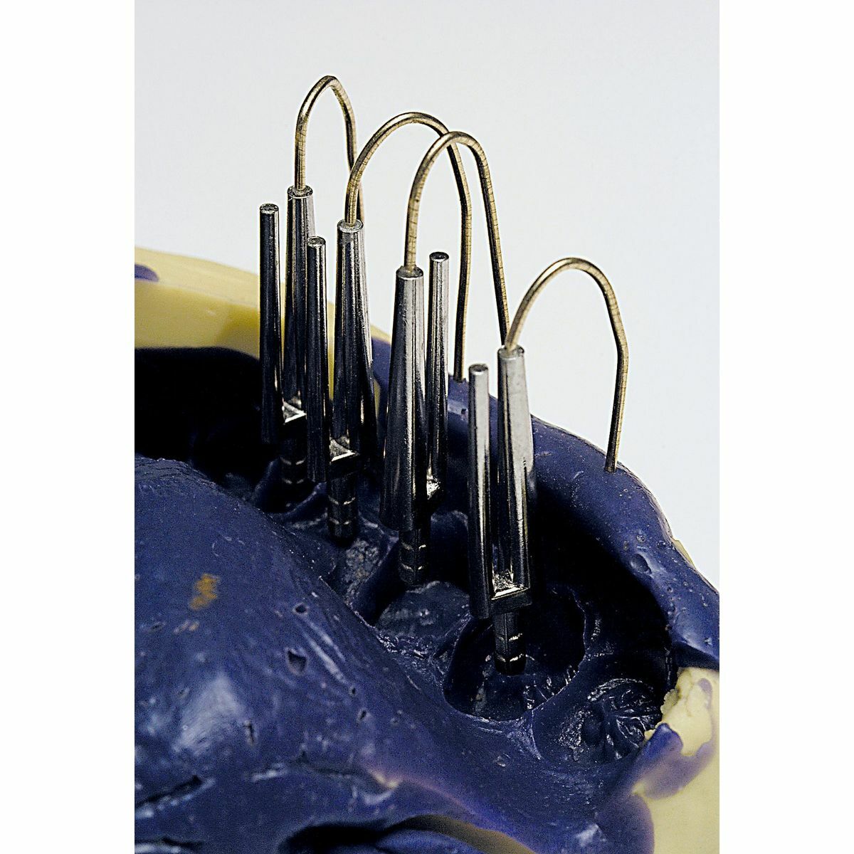 Renfert Bi-Fix-Pin Model Pin - 100 pack – Garland Dental Services